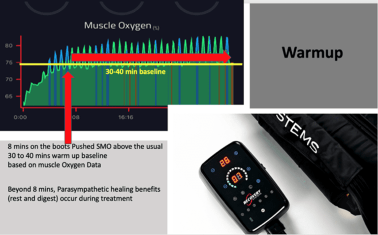 The Complete Guide to Intermittent Compression Devices for 2023 ...